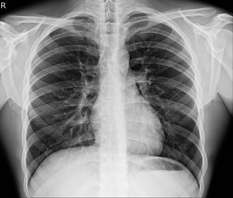 Ακτινογραφία – Μπαρός Ακτινοδιαγνωστική